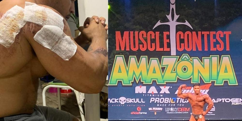 Atleta supera sequelas de acidente e vence Muscle Contest Amazônia 2023